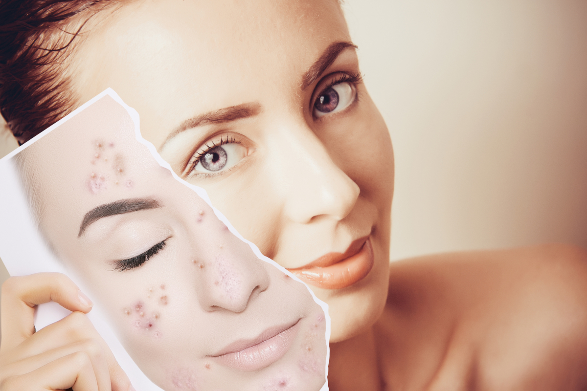 DermalInfusion Facial Treatment - Rancho Santa Fe, CA - North County ...